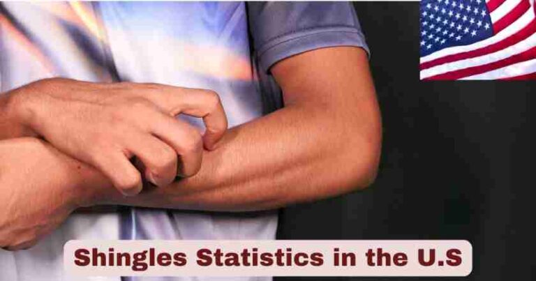 Shingles Statistics in the U.S. 2025 | Shingles Facts – The Global ...